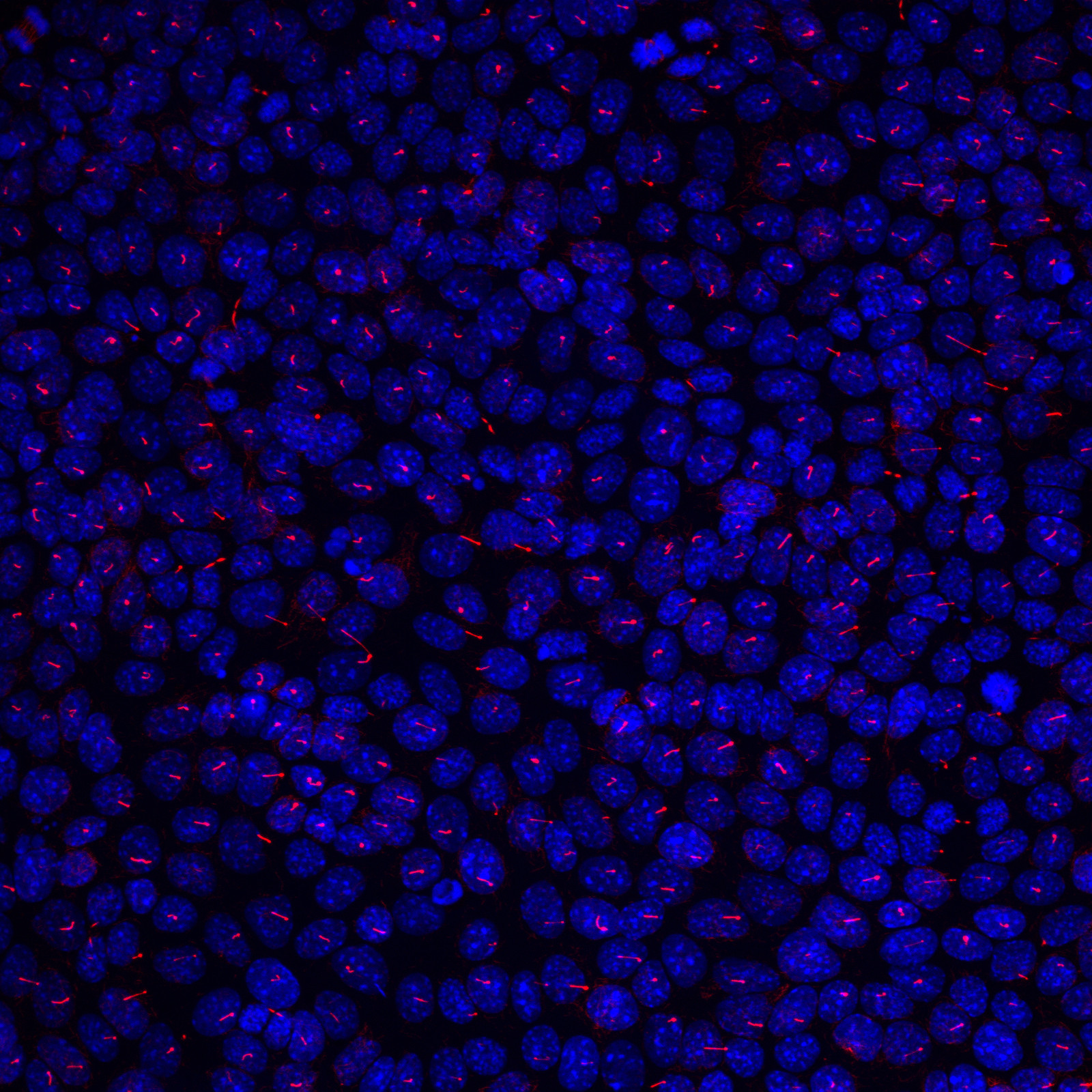 Edor Kabashi | Institut Imagine